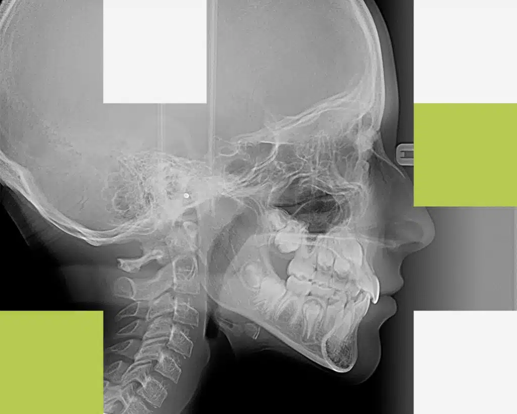 Tipurile de radiografii dentare - DigiRay #OneStopScanningShop